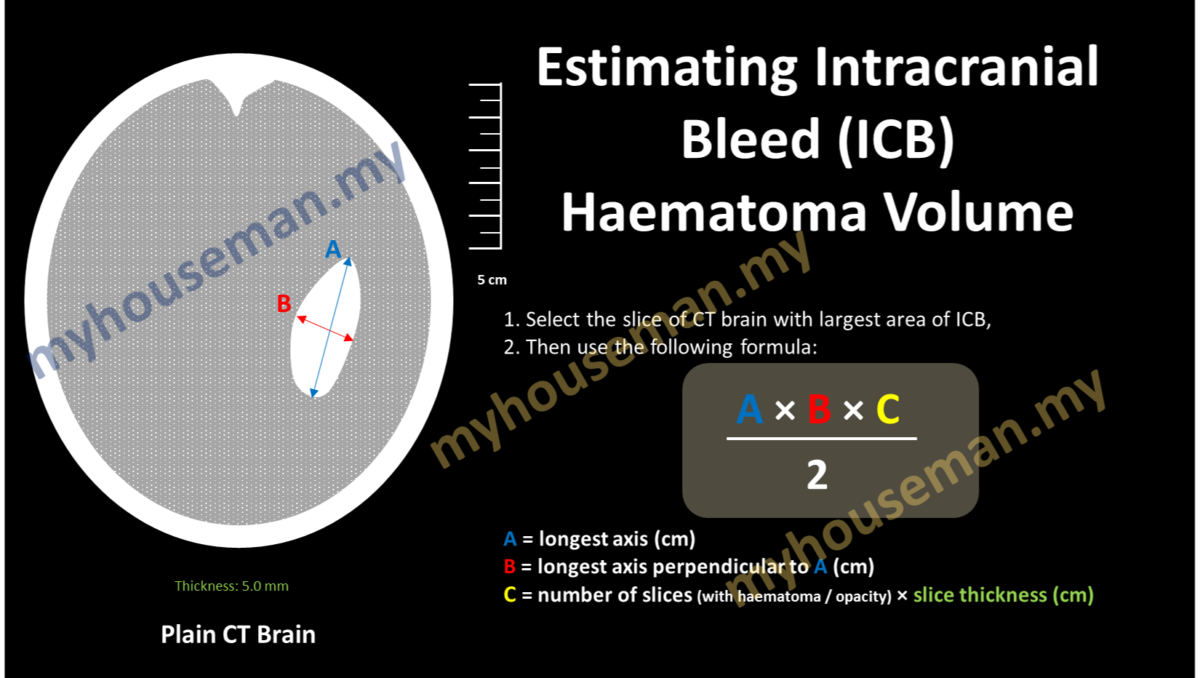 Intracranial Bleed (ICB) - House Officer Guide